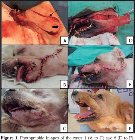 Figure 1 From Use Of The Angularis Oris Axial Pattern Buccal Flap For