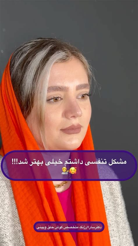 ‎دکترسارا ارژنگ جراح بینی‎ ‎ماساژ صحیح بینی بعد‌جراحی بینی 💥🤩