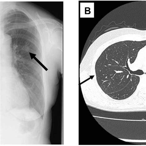 Chest And Facial X Ray And Computed Tomography CT Findings Of Patient Download Scientific
