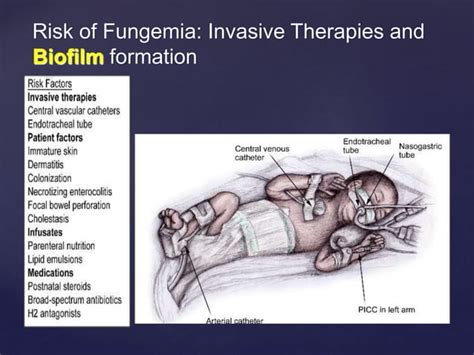 Fungal Sepsisfinalnnf Keralakims2019 Dr Karthik Nagesh Ppt