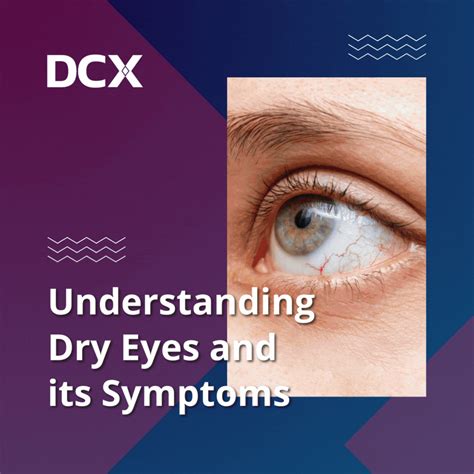 Dcx Ph Inc On Linkedin Tuesday Health And Wellness Tips Understanding Dry Eyes And Its Symptoms…