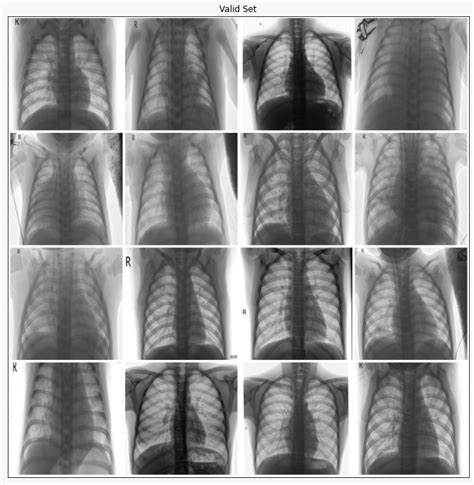 Loss Is Increasing And Accuracy Is Decreasing Pytorch Forums
