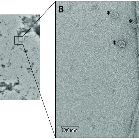 Negative Stain Tem Of 3cl Pro Induced Tau Fibrils A Representative Download Scientific