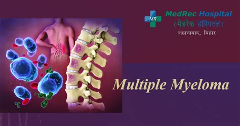 Multiple Myeloma Risk Factors Complications And Treatment