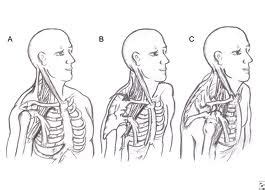 Why Pec Minor Can Be A Major Pain MobilizeMe Physiotherapy