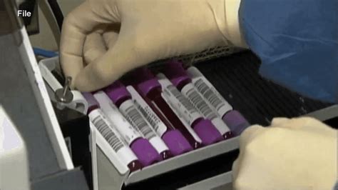 World Aids Day Dhec Boosts Hiv Testing In Honor Of Lives Lost And