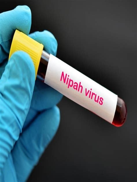 Nipah Virus Kills Two In Kerala Check Symptoms And Prevention Measures