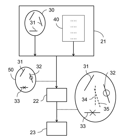 Planning System For Neurostimulation Therapy Eureka Patsnap Planning System For Neurostimulation Therapy Eureka Patsnap