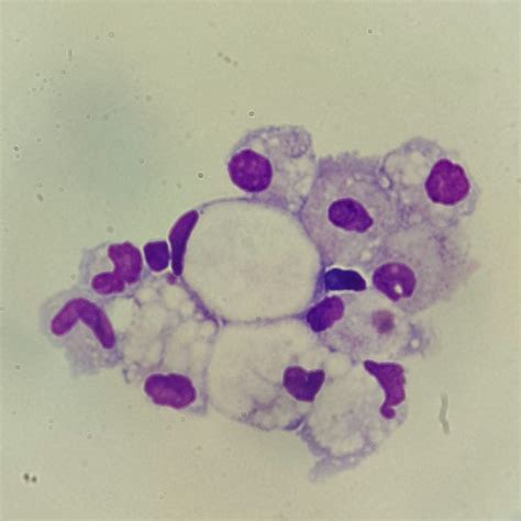 Body Fluid Monocytes Macrophages Medlabbuddy