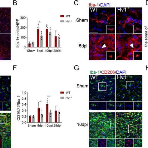 Lpc Induced Demyelination Was Ameliorated By Hv1 Deficiency A Download Scientific Diagram