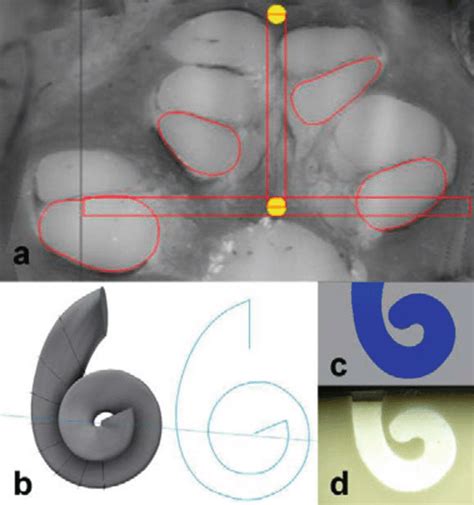 Generation Of The Cochlear Models Through Scala Tympani Segmentation