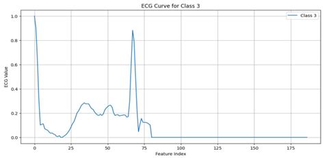 Reliable Ecg Anomaly Detection On Edge Devices For Internet Of Medical Things Applications Pmc