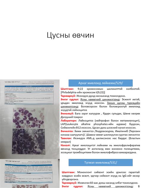 Эмгэг судлал тохиолдол Pdf