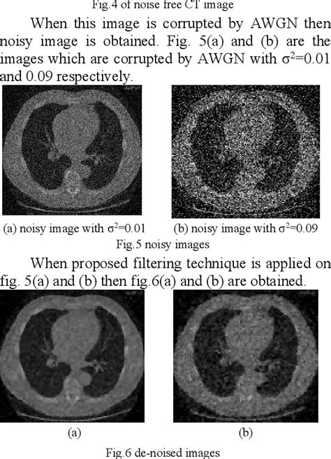 table 1 from reduction of gaussian noise from computed tomography