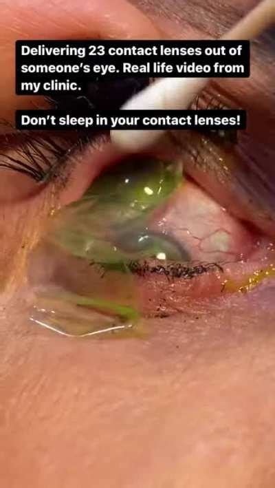 NFC NoFuckingComment REDD TUBE