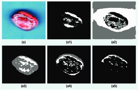 Impact Of Exponential Parameter P In Segmentation Results A Original Download Scientific