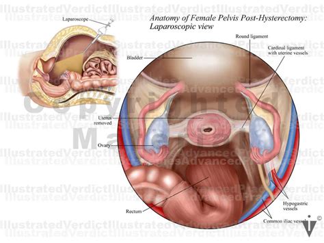 Female Pelvic Anatomy Laparoscopic