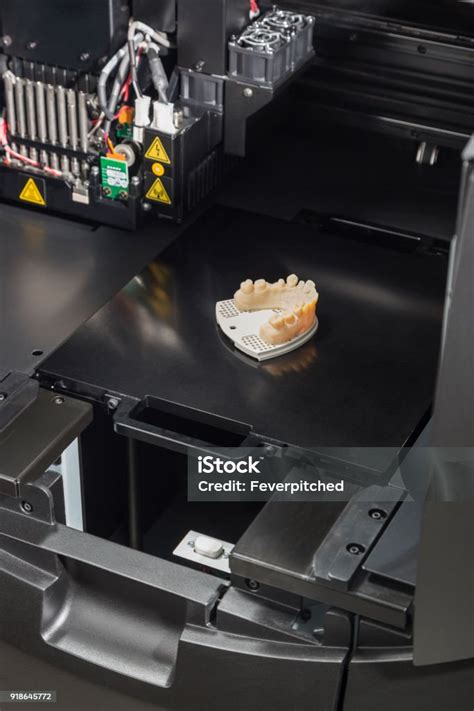 완성 된 3d와 3d 프린터 인쇄 치과 임 플 란 트 브릿지 3차원 인쇄에 대한 스톡 사진 및 기타 이미지 3차원 인쇄 치아 건강 치과 장비 Istock