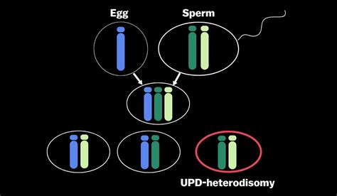 Understanding How Upd Happens In Angelman Syndrome