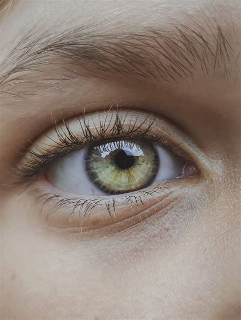 How To Treat Seborrheic Dermatitis Of The Eyebrows