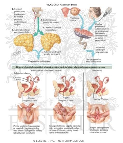 Disorders Of Sex Differentiation
