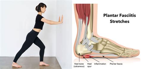 Exercises For Plantar Fasciitis Plantar Fasciitis Exercises And Home