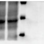 EphB Induced VASP Tyrosine Phosphorylation Abrogates Zyxin VASP