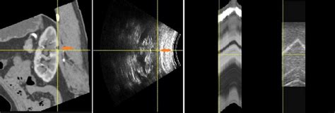 Example Image Pair To Visualize Target Registration Error Tre On A Download Scientific