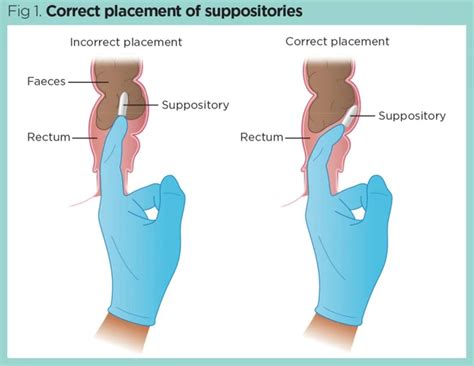 The Benefits Of Rectal Massage A Guide To Improved Wellness