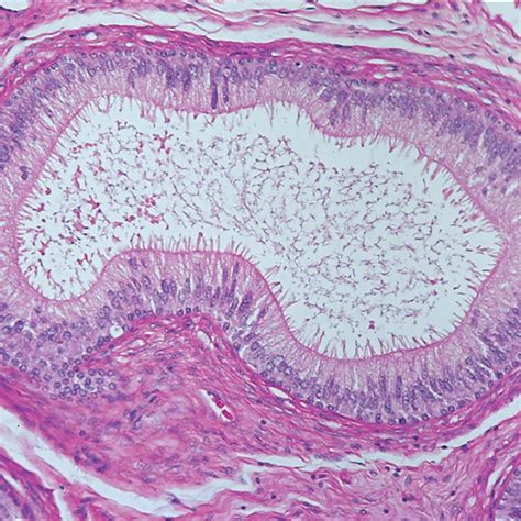 Human Epididymis Sec 7 µm Hande Microscope Slide Carolina Biological