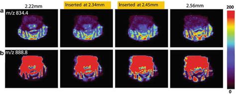 Data Processing And Analysis For Mass Spectrometry Imaging Radiology Key