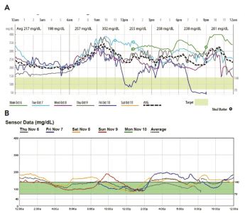 CGM Technology How It Can Help You Master Diabetes