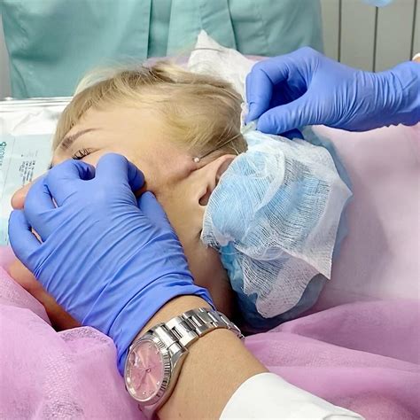 Setting The Threads Estetvelkievua