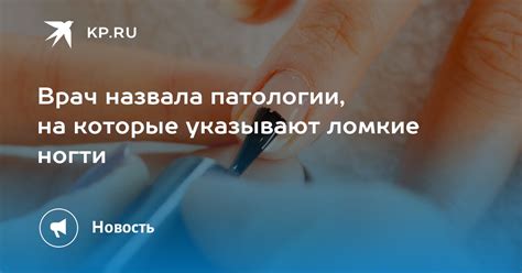 Врач назвала патологии на которые указывают ломкие ногти Kp Ru