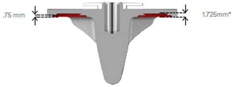 Cross Section Of The New Tibial Baseplate Showing The Thickness Of The