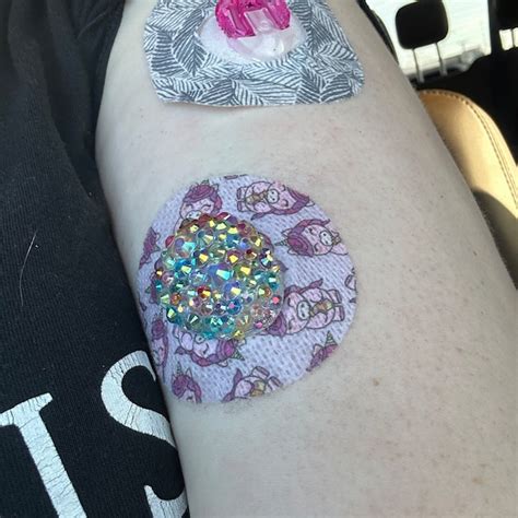 Original© Omnipod Cover Reusable Dexcom G6 Cover Xoxo White Pink Opal