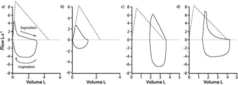 How To Calculate Predictive Flow Volume Curve In Spirometry From