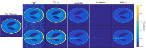 sparse view ct with 32 directions download scientific diagram