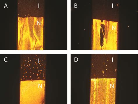 Photographs In Polarized Light Microscopy Of Biphasic Isotropic Nematic