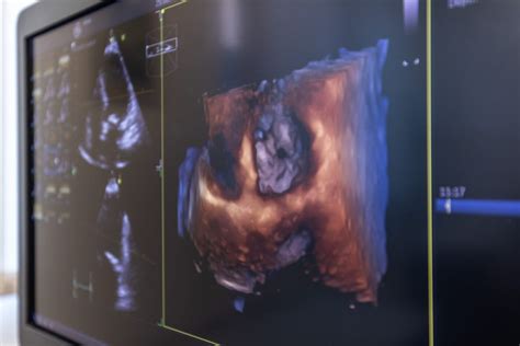 МЦ по Сърдечно съдови заболявания Супердок