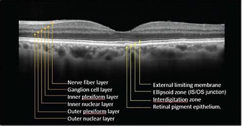 Learning To Read Retinal OCT Ophthalmology Management