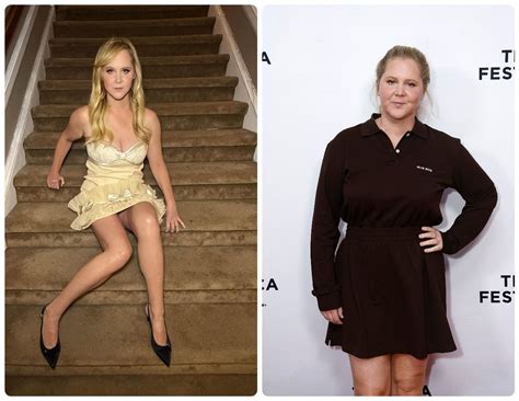 Amy Schumer Credits 22kg Weight Loss To Cushings Disease Battle The Star