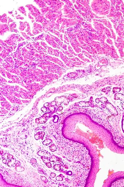 Stratified Squamous Epithelium Stock Photo Panxunbin