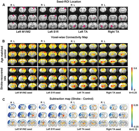 Functional Connectivity Maps According To Seed Rois M1 M2 S1fl And Download Scientific