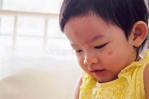 Nettes Kleines Asiatisches M Dchen Mit Roter Plansenkung Der Allergie Stockbild Bild Von