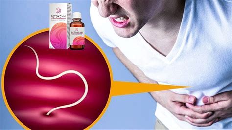 Ретоксин От Глистов Отзывы Youtube