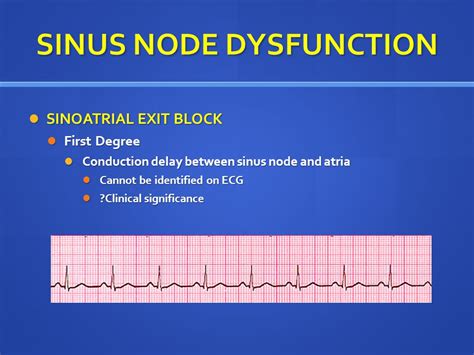 Heart Blocks And Cardiac Pacemakers Ppt Video Online Download