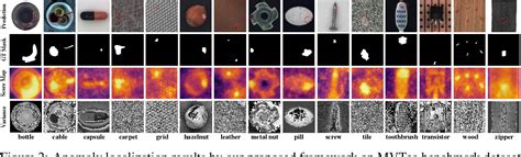 Figure 2 From Sanflow Semantic Aware Normalizing Flow For Anomaly Detection Semantic Scholar
