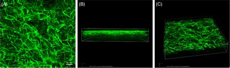 Confocal‐imaging‐based 3d Reconstruction Of A Full‐thickness Sheet Of Download Scientific
