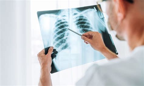 Radiologists Outperform Ai In Identifying Lung Diseases On Chest X Ray Health Tech World